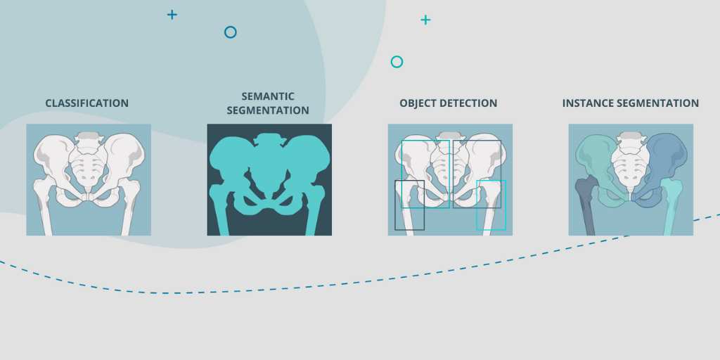 What Is Image Segmentation And How To Use It In Orthopedics